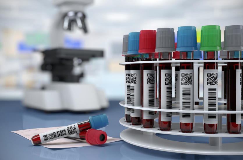 Czym są próby wątrobowe