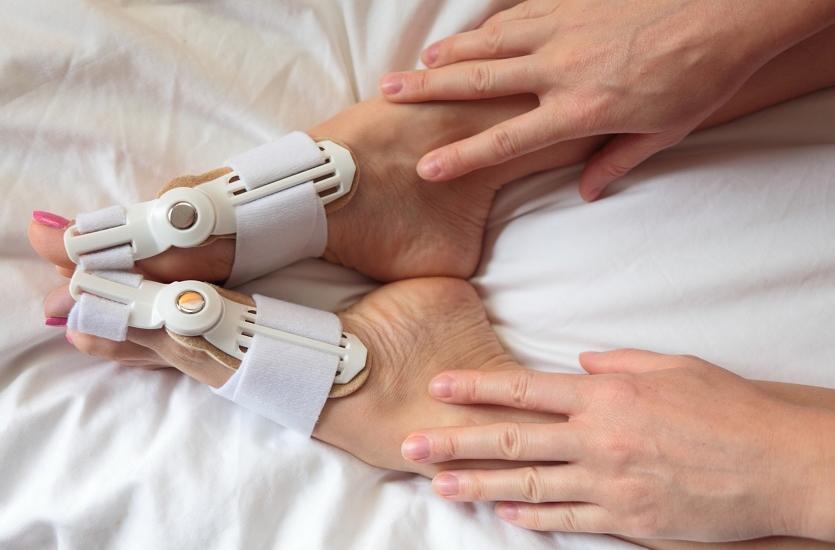 Jakie są deformacje i patologie stóp? Odpowiadamy!